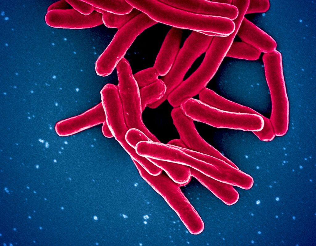 Types of Airborne Diseases - SimplExplainer