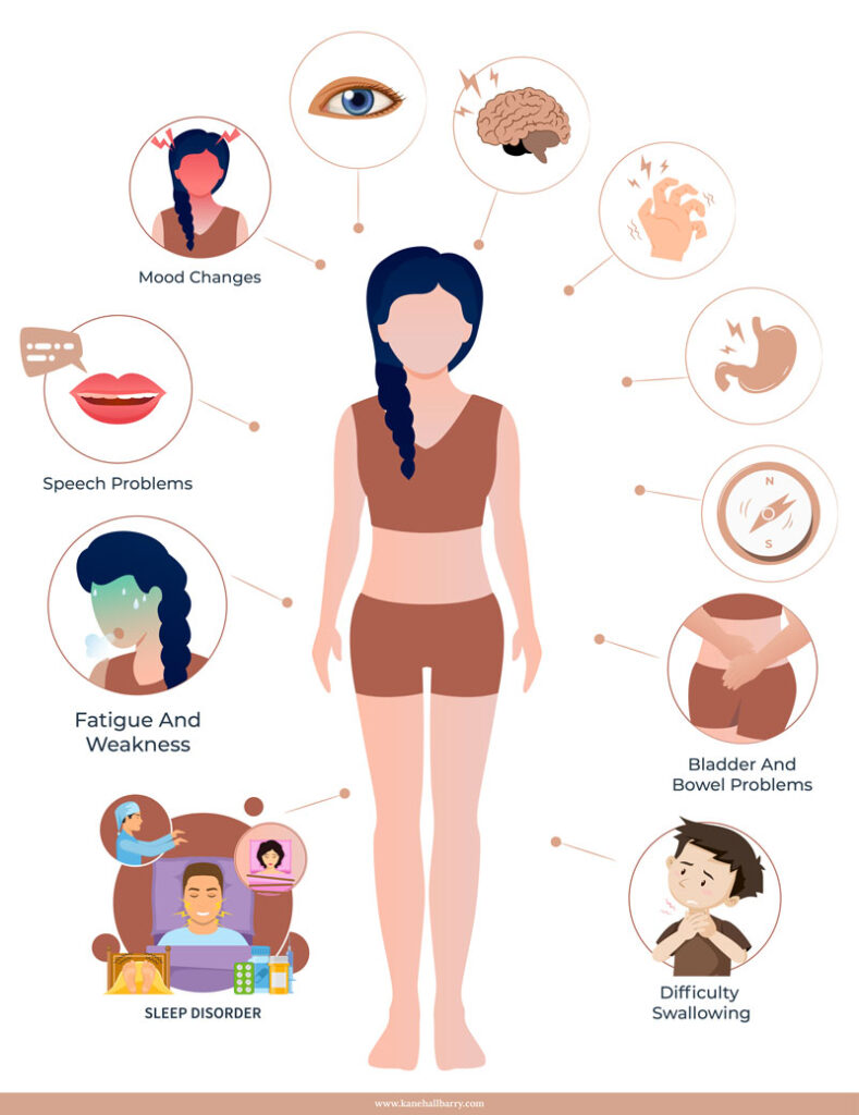 Prevention of Multiple Sclerosis - SimplExplainer