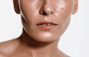 Excess Oil Production on the Skin: Causes, Effects, and Solutions ...