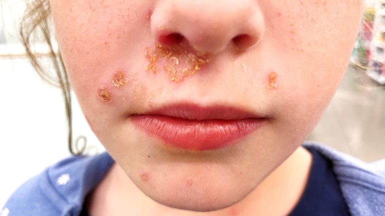 The 4 Key Benefits of Egg Yolk for Skin Health - SimplExplainer