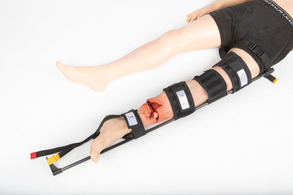 Types of Splint - SimplExplainer