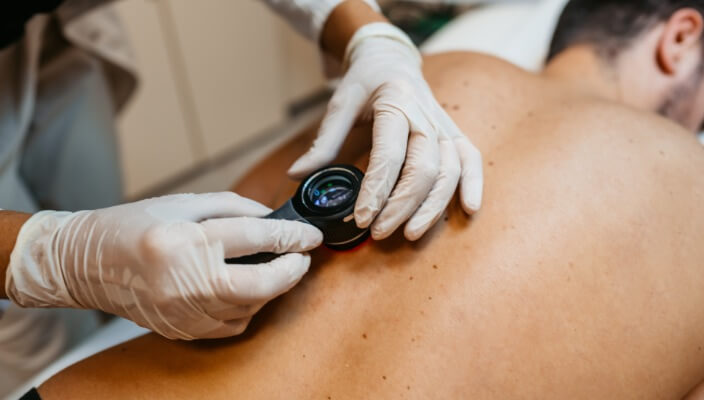 Excess Oil Production on the Skin: Causes, Effects, and Solutions ...